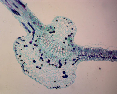 Prepared Microscope Slide, Begonia Leaf; Cross Section