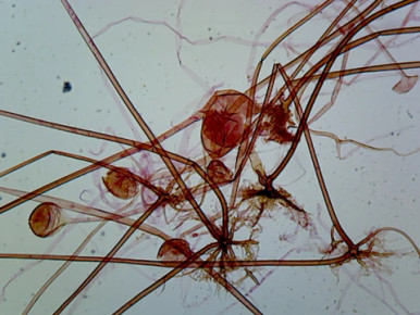 Rhizopus Under Microscope