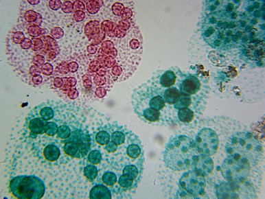 Prepared Microscope Slide, Volvox, Asexual Reproduction; Showing ...