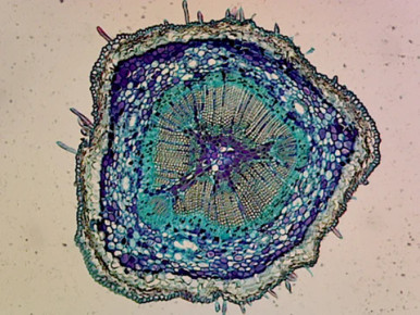 Prepared Microscope Slide, Pine (Gymnosperms) Ovulate Cone; Showing ...
