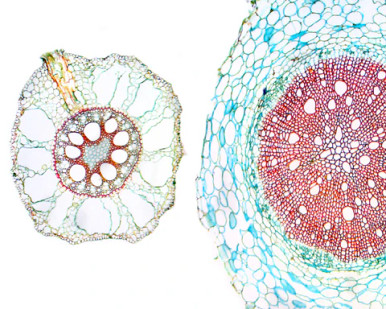 Prepared Microscope Slide, Angiosperm Root; Monocot and Dicot ...