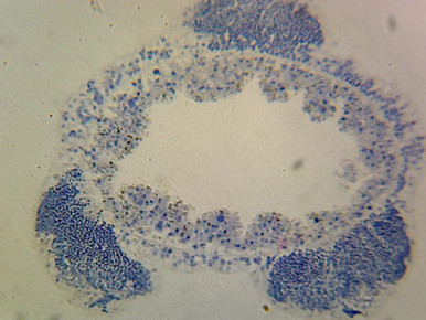 Prepared Microscope Slide, Hydra with Male Gonad (Spermary); Whole-mount