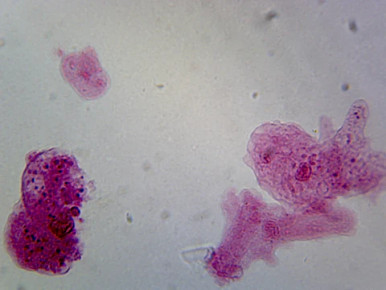 Prepared Microscope Slide, Amoeba Proteus, General Cellular Structure ...