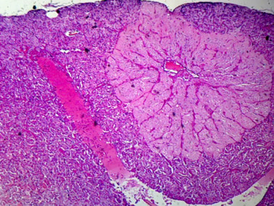 Prepared Microscope Slide, Hypophysis (Pituitary Gland); Section