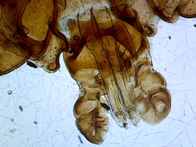 Prepared Microscope Slide, Tick (Arachnid); Whole-mount