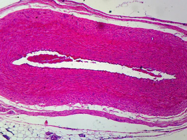 Prepared Microscope Slide, Capillary from Omentum, Mammalian; Whole-mount