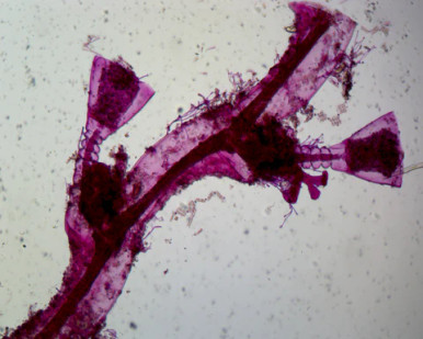 obelia hydroid under microscope