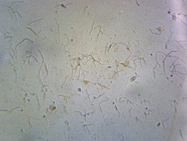 Prepared Microscope Slide, Leptospira (Spirochetes); Smear