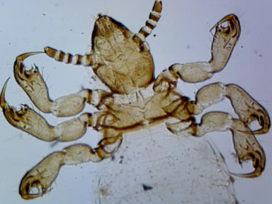 Prepared Microscope Slide, Pediculus Humanus Capitis, Female; Whole-mount