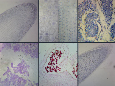 General Biology Microscope Slide Set – 6 Slides