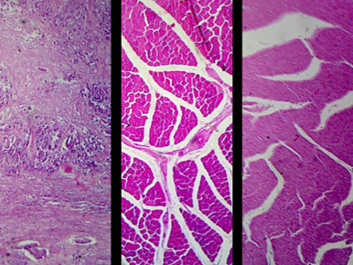 Prepared Microscope Slide – Mammalian Muscle Types