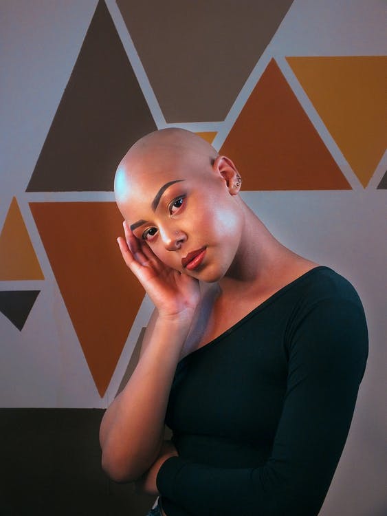 Alopecia: What Causes It and How Can you Help Treat It? - Aura Sensory