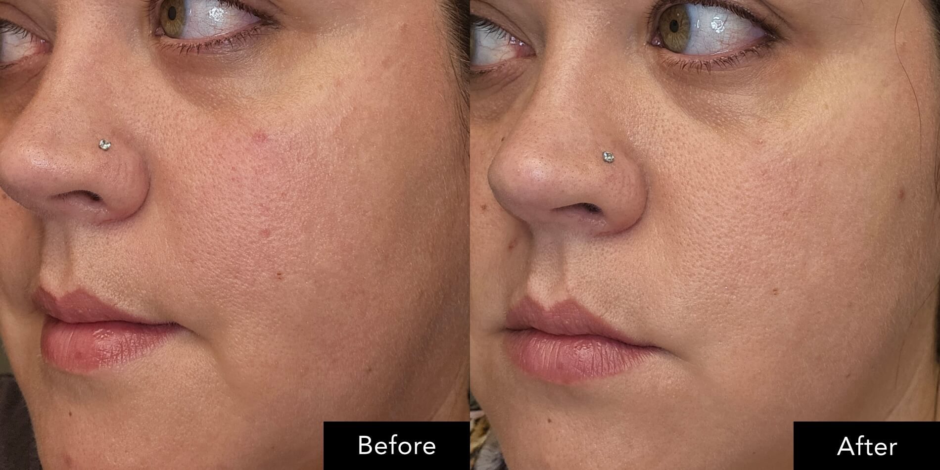 PITERA™ Ultimate Aura Essentials Kit - Skincare Set | SK-II US