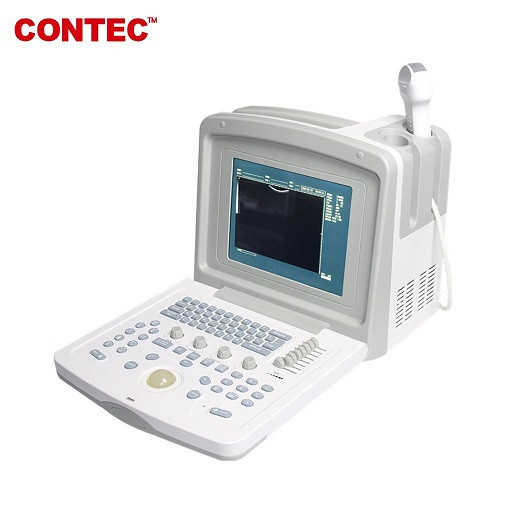 Buy Online CONTEC CMS600B-3 Portable Full Digital Ultrasound Scanner ...
