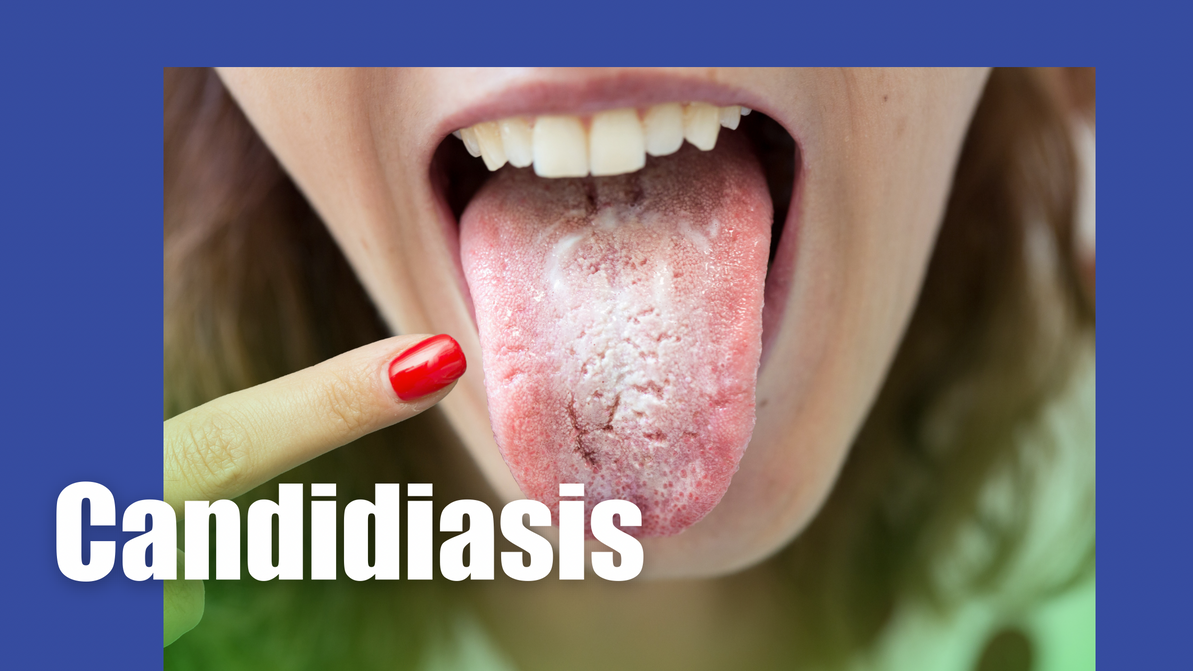 What is Candida Albicans? - Optimize Nutrition