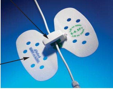 BD VUPD68 - Catheter / Line Securement Device Statlock® Universal ...