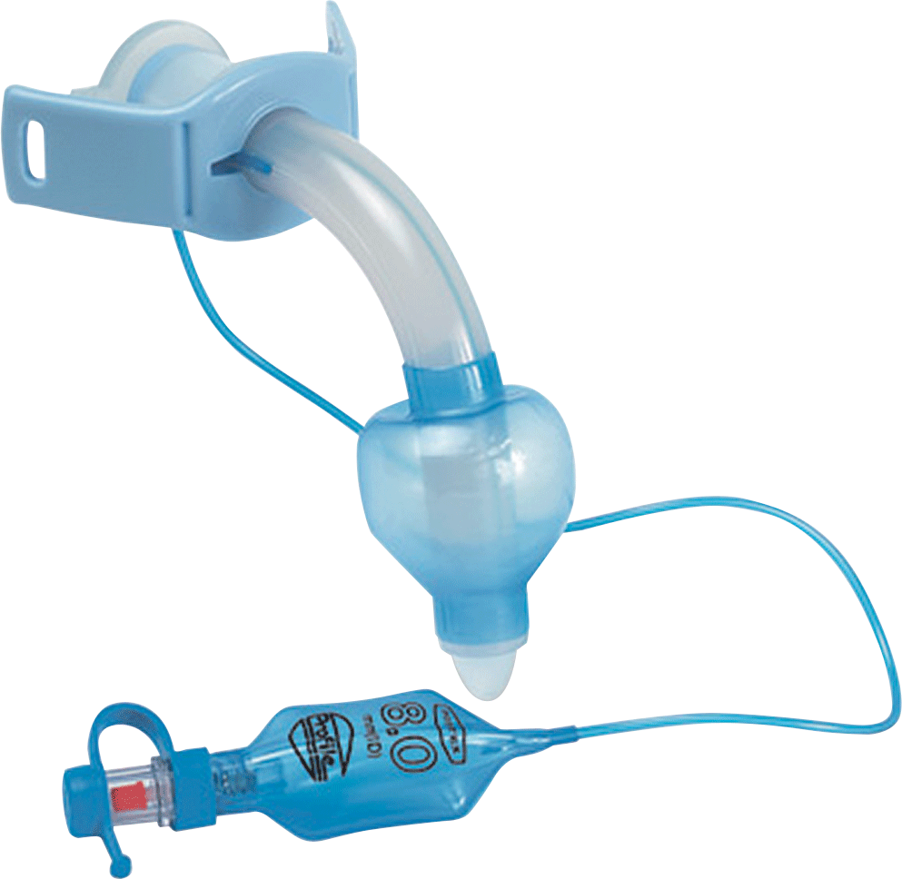 Smiths Medical 100/815/060 - Blue Line Ultra Tracheostomy Tube Kit 6 mm ...