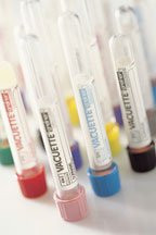 Greiner Bio-One 456002 - VACUETTE® Venous Blood Collection Tube K2 EDTA ...