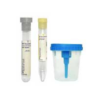 Shop BD 364956 - BD Vacutainer Urine Collection Kit with Screw-Cap Cup ...