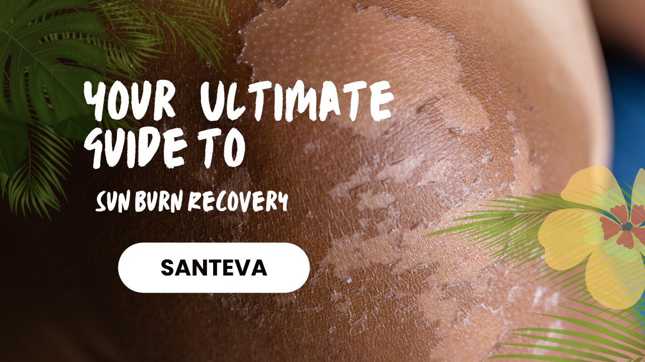 Your Ultimate Guide to Sunburn Recovery - Santeva