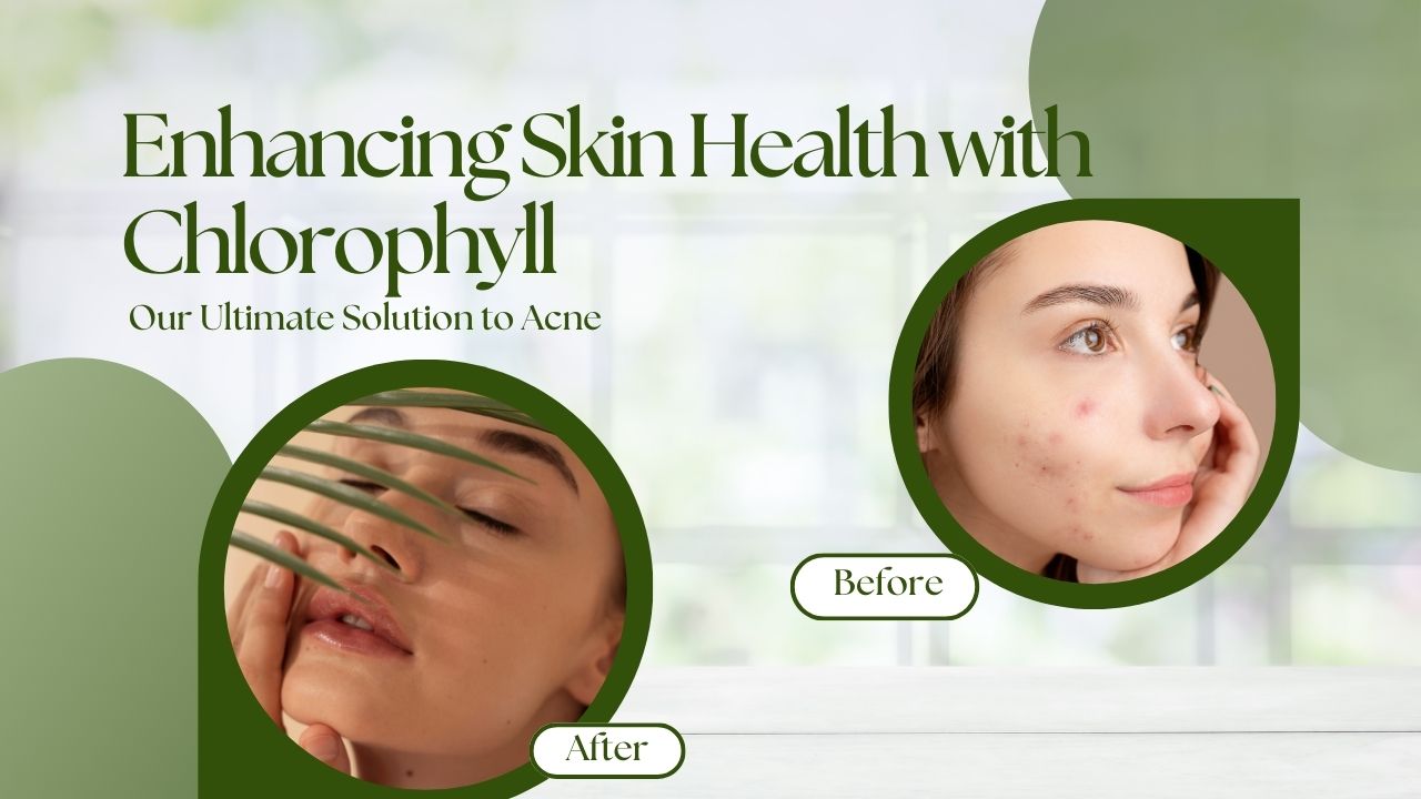 Benefits of Chlorophyll for Acne - Santeva