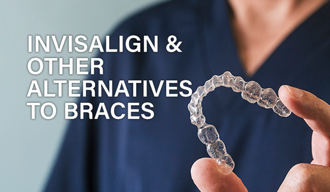 Straightening Teeth Discreetly Invisalign And Other Alternatives To