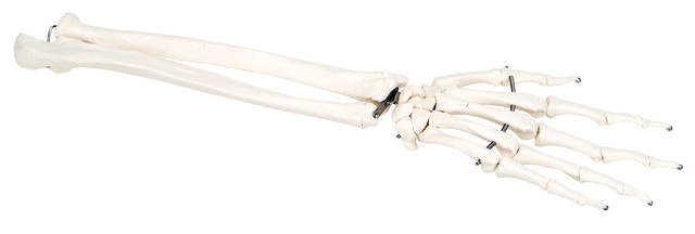 Anatomical Model - Loose Bones, Left Hand Skeleton with Ulna and Radius