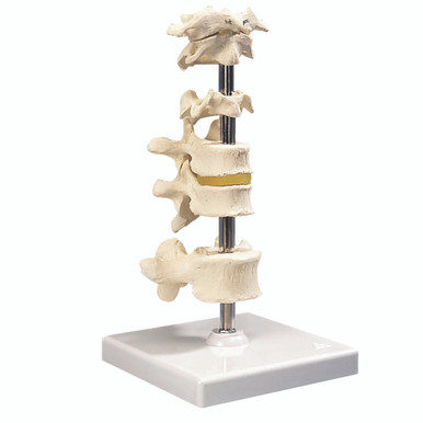 3B Scientific Anatomical Model - 6 Vertebrae with Stand
