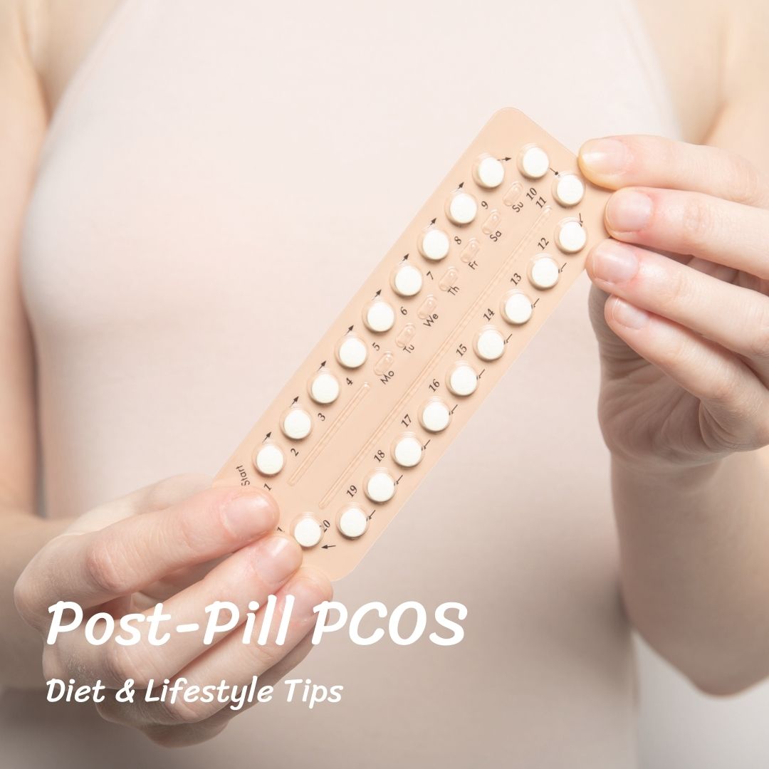 Post-Pill PCOS - Diet & Lifestyle Tips - Natural Chemist