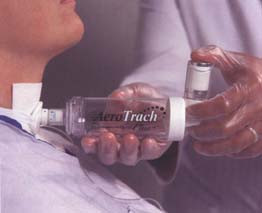 AeroTrach Plus VHC - 52510 | Monaghan Medical | MedTek