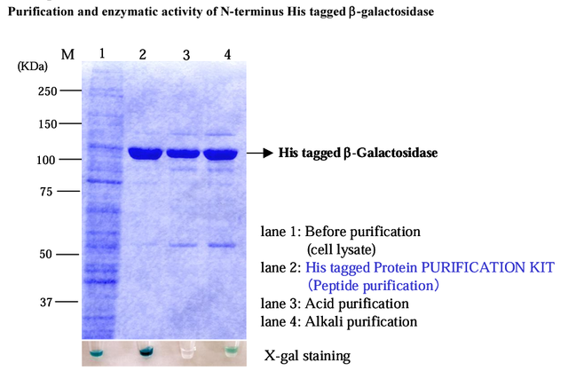 His tagged Protein PURIFICATION KIT [Catalog No.: MBL-3310,MBL-3310A]