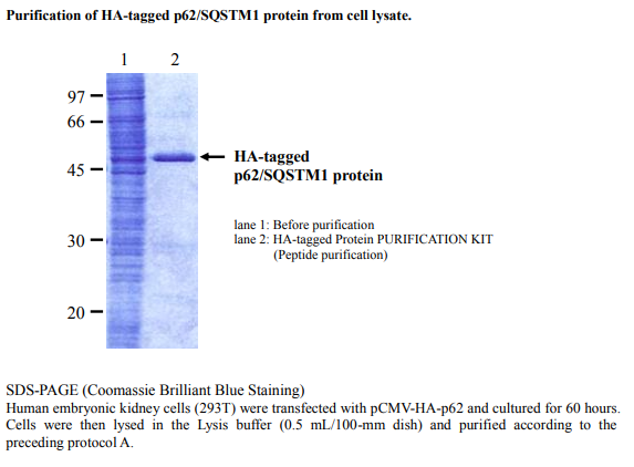 HA tagged Protein PURIFICATION KIT [Catalog No.: MBL-3320]