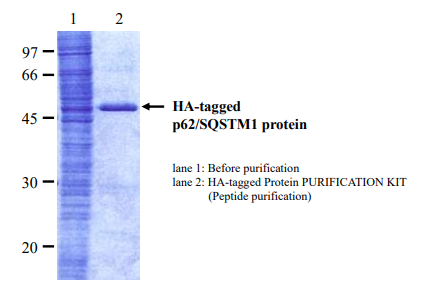HA tagged Protein PURIFICATION KIT (Trial Kit) [Catalog No.: MBL-3320A]