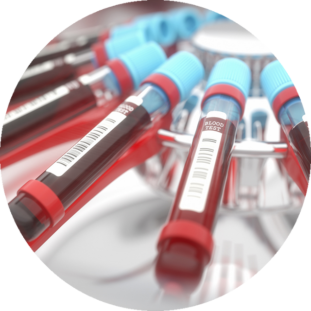 OptiPrep™ - Density Gradient Media (Iodixanol) [Catalog No.: AXS ...