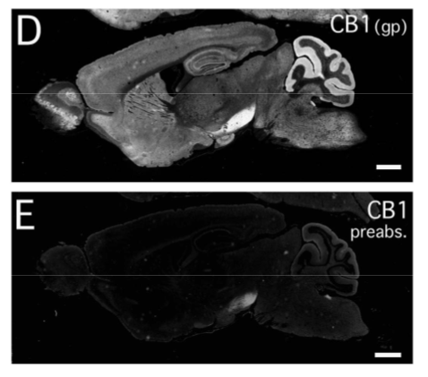 Anti CB1 (cannabinoid receptor-1) pAb Antibody (Host: Guinea Pig ...