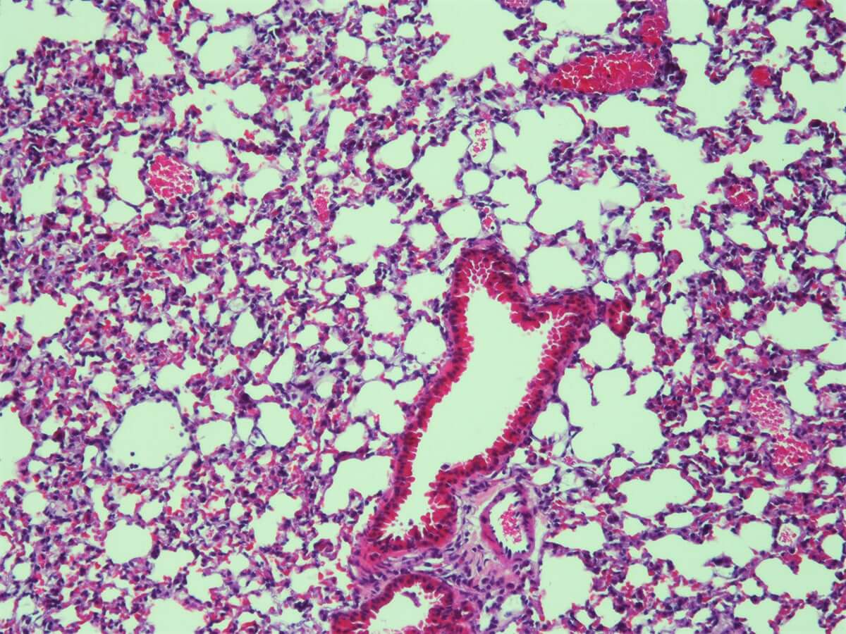 Mayer's Hematoxylin and Eosin Stain Kit