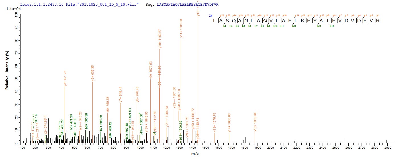 Recombinant Human AP-1 complex subunit beta-1(AP1B1),partial (CSB ...