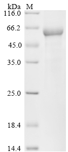 Recombinant Human Cyclin-dependent kinase 7(CDK7) (CSB-EP005075HU)