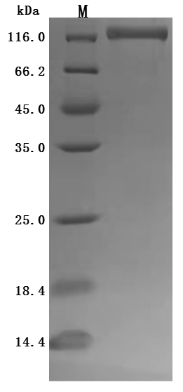 Recombinant Human Ectonucleotide pyrophosphatase/phosphodiesterase ...