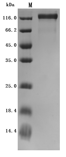 Recombinant Rat Microtubule-associated protein tau(Mapt) (Active) (CSB ...