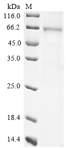 Recombinant Mouse Desmoglein-3(Dsg3),partial (CSB-BP007205MOc7)
