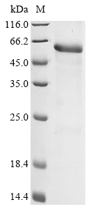 Recombinant Human Adenomatous polyposis coli protein(APC),partial (CSB ...