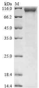 Recombinant Human Sucrase-isomaltase, intestinal(SI),partial (CSB ...