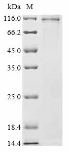 Recombinant Human Sucrase-isomaltase, intestinal(SI),partial (CSB ...