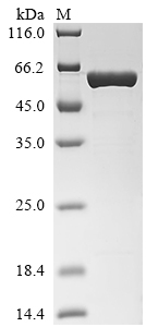 Recombinant Human Insulin receptor substrate 1(IRS1),partial ...