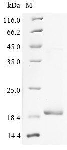 Recombinant Human Troponin C, slow skeletal and cardiac muscles(TNNC1 ...