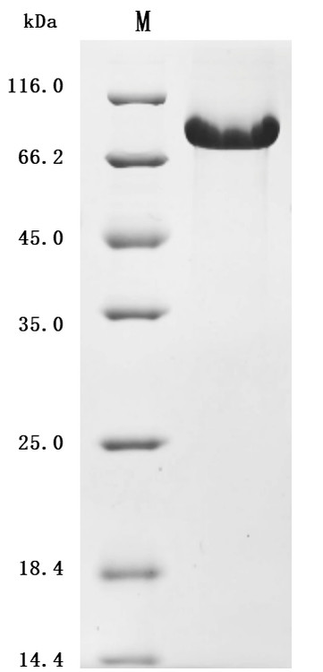 Recombinant Human Complement component C1q receptor(CD93),partial ...