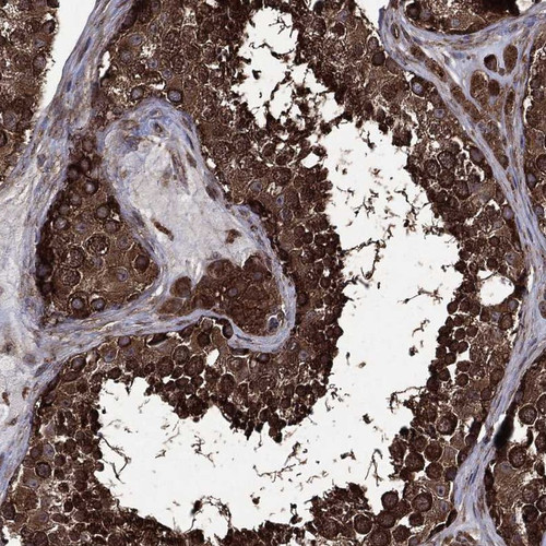 Anti-EIF2B4 pAb (ATL-HPA068855)