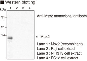 Anti-Msx2 (Human) mAb (Clone: 2E12) [Catalog No.: MBL-M027-3]