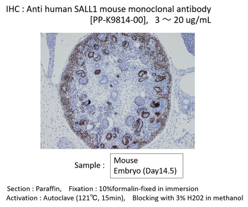 Anti SALL1 mAb Antibody (Clone K9814) [Catalog No.: PPX-PP-K9814-0C]
